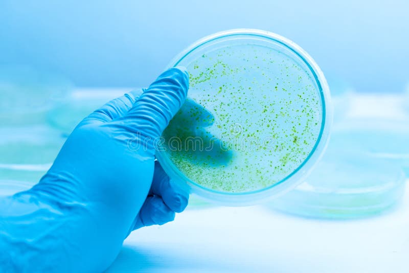 Colony of Blue Green Algae in Culture Medium Plate Stock Image - Image ...