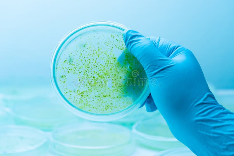 Colony of Blue Green Algae in Culture Medium Plate Stock Photo - Image ...