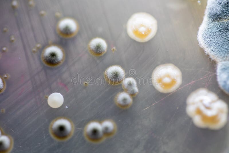 Colony Characteristic of Actinomyces, Bacteria, Yeast and Mold on ...