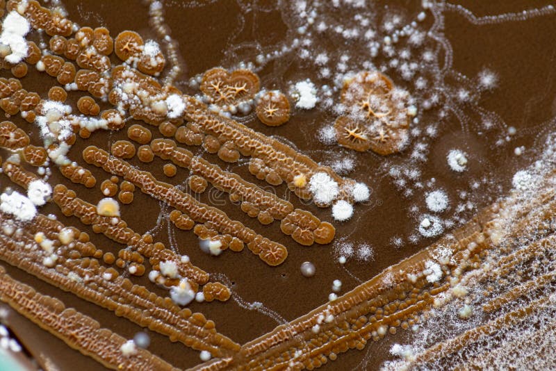 Colony Characteristic of Actinomyces, Bacteria, Yeast and Mold on ...