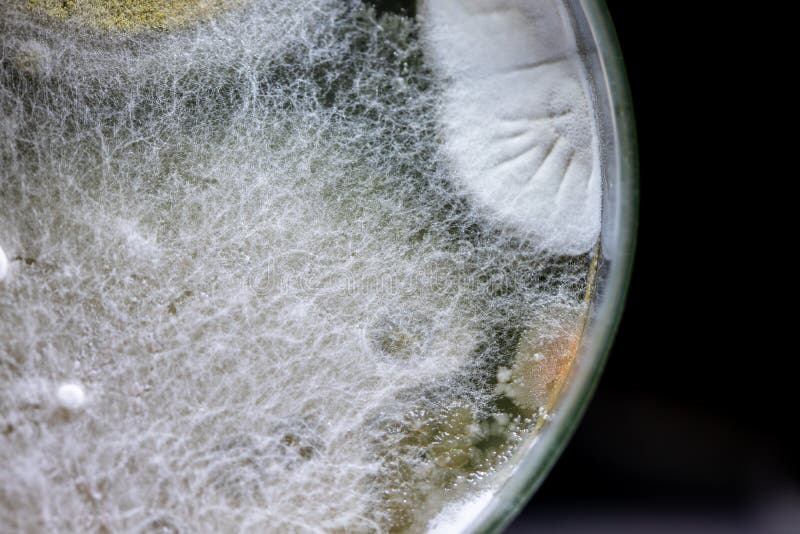 Colony Characteristics of Mold Under the Microscope. Stock Photo ...