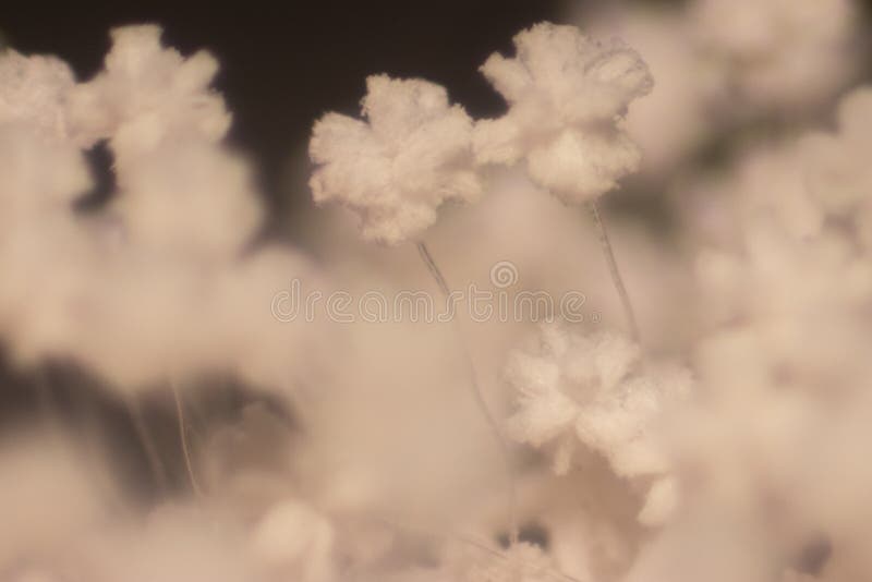 Colony Characteristics of Mold Under the Microscope. Stock Image ...