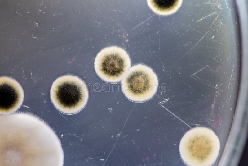 Colony Characteristics of Mold Under the Microscope. Stock Photo ...
