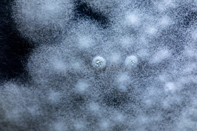 Colony Characteristics of Mold Under the Microscope. Stock Photo ...