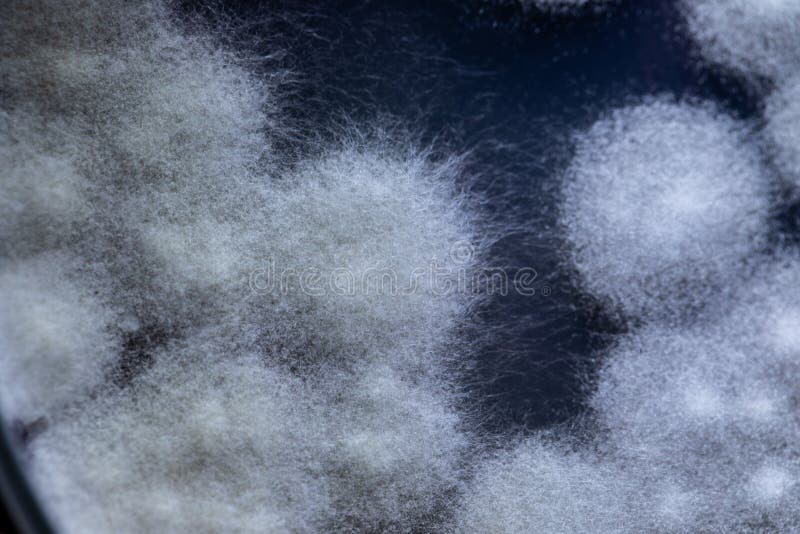 Colony Characteristics of Mold Under the Microscope. Stock Image ...