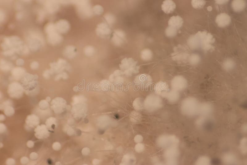 Colony Characteristics of Mold Under the Microscope. Stock Photo ...