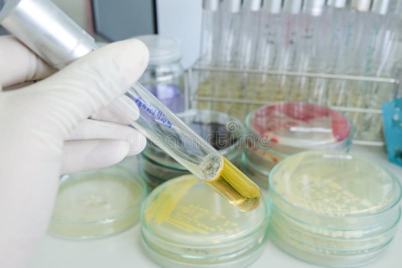 Colony of fungi stock photo. Image of penicillum, macro - 93206576