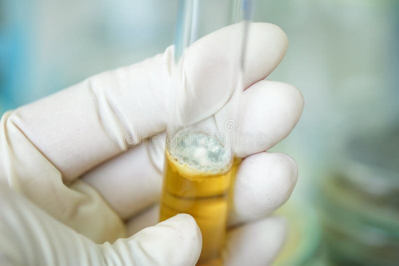 Colony of fungi stock image. Image of chemical, dish - 93206681