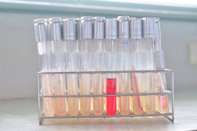Agar in Test Tube Rack for Testing Microbiology Laboratory Stock Image ...