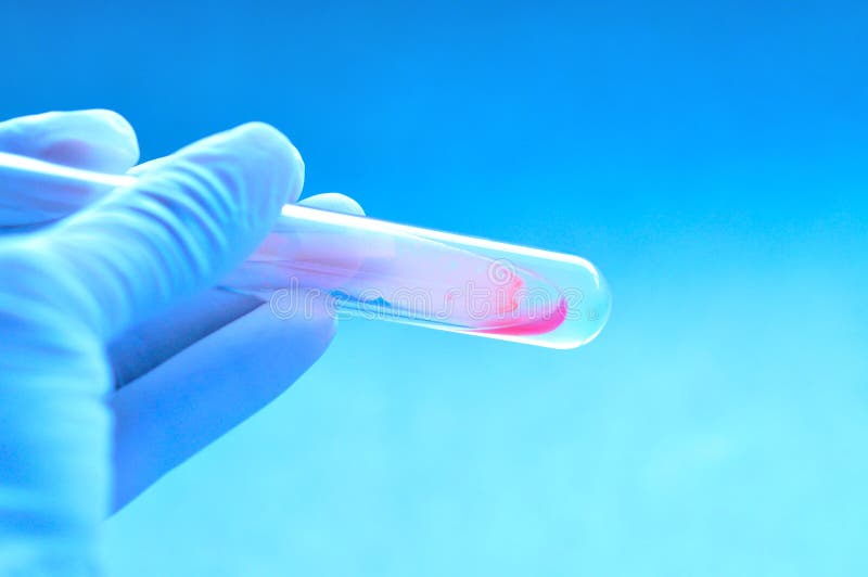 Colony in slant agar stock photo. Image of medicine, culture - 43355268