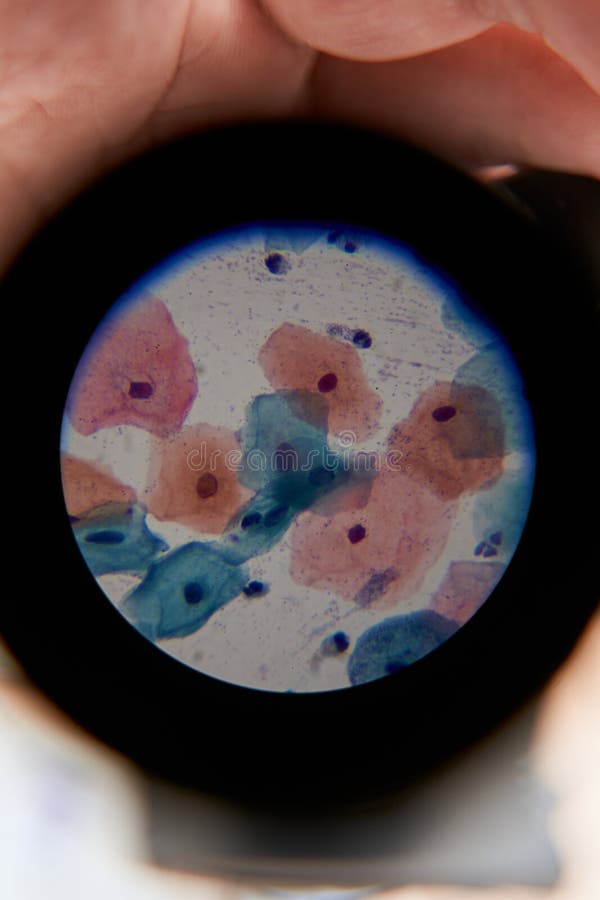 Color Image in Microscope of Microorganisms in the Lab Stock Image ...