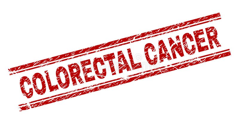 Colorectal Cancer Stock Illustrations – 945 Colorectal Cancer Stock ...