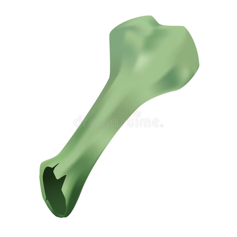 Colored Detailed Broken Bone Vector Stock Vector - Illustration of flat ...