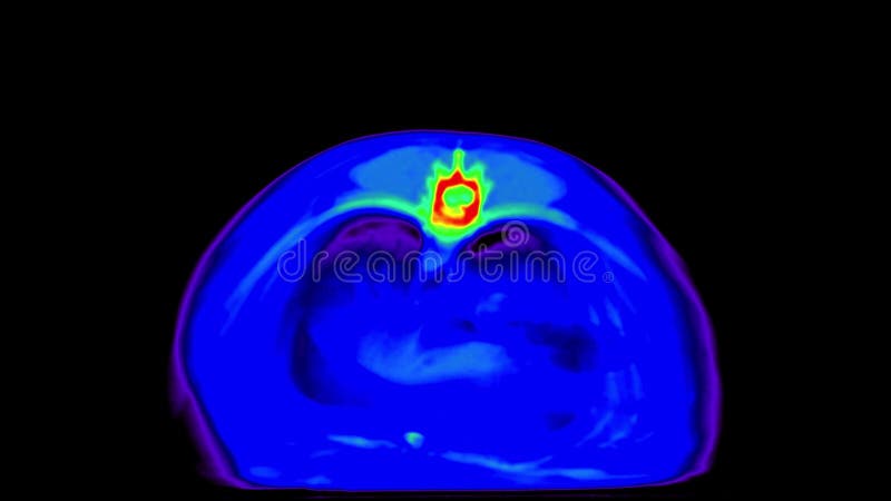 X Ray Ct Scan Of A Cat Stock Video Video Of Isolated 261408917