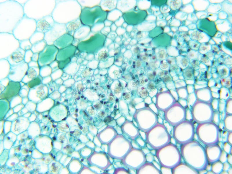 Cotton Leaf 400x Magnification Stained Stock Image - Image of view ...