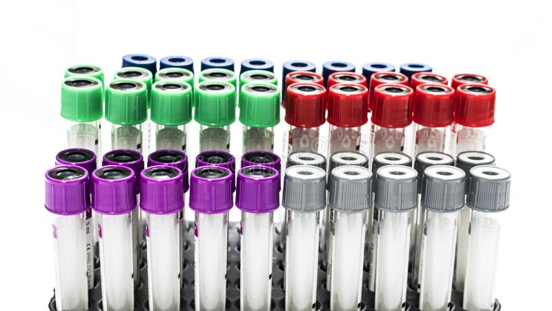 Colorful laboratory tube. stock photo. Image of medical - 81002182