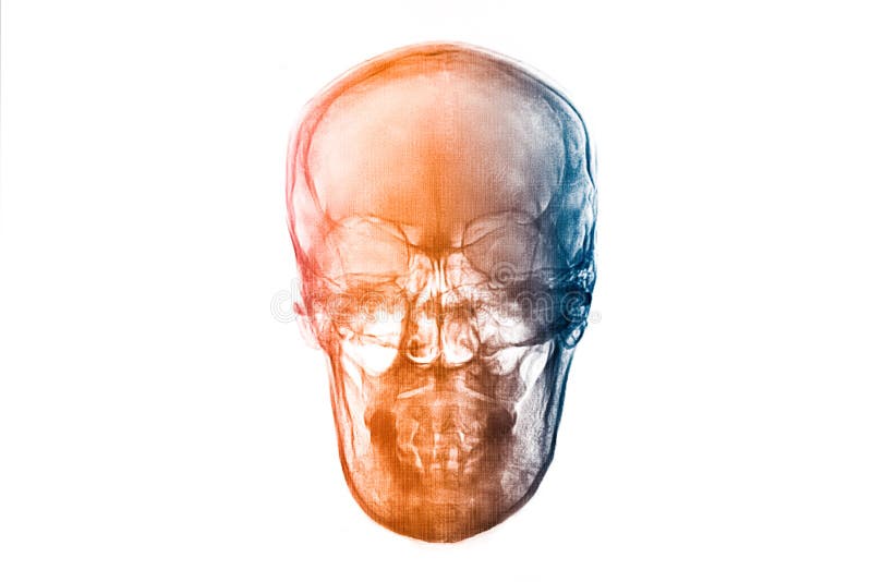 Colorful Skull Human X-rays Image Stock Image - Image of xray, human ...