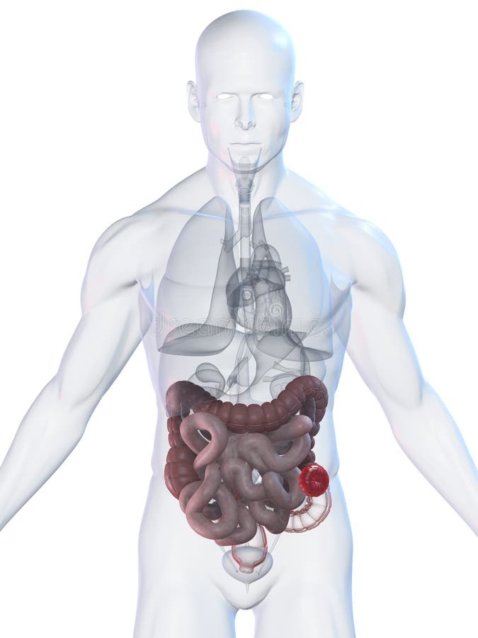 Colostomy bags stock image. Image of colon, health, healthcare - 16267849