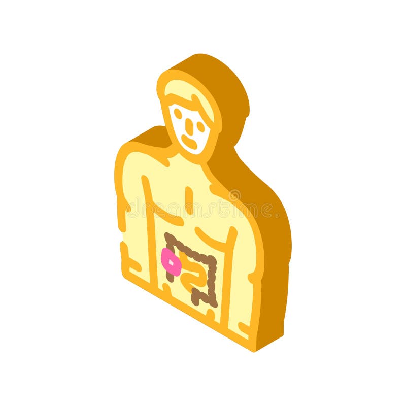Colostomy Surgery Isometric Icon Vector Illustration Stock Vector ...