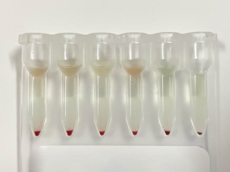 Colume Gel in Crossmatching Testing Stock Image - Image of blood ...