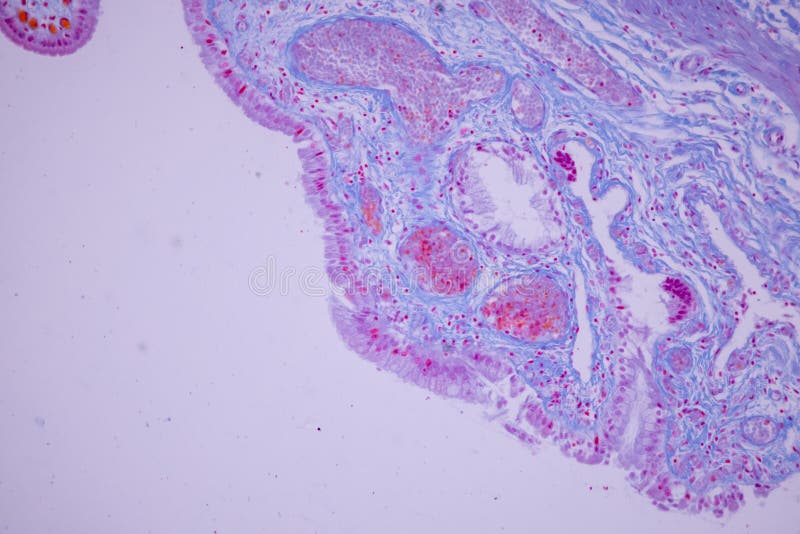 Columnar Epithelium of Human Gall Bladder Under the Microscope in Lab ...