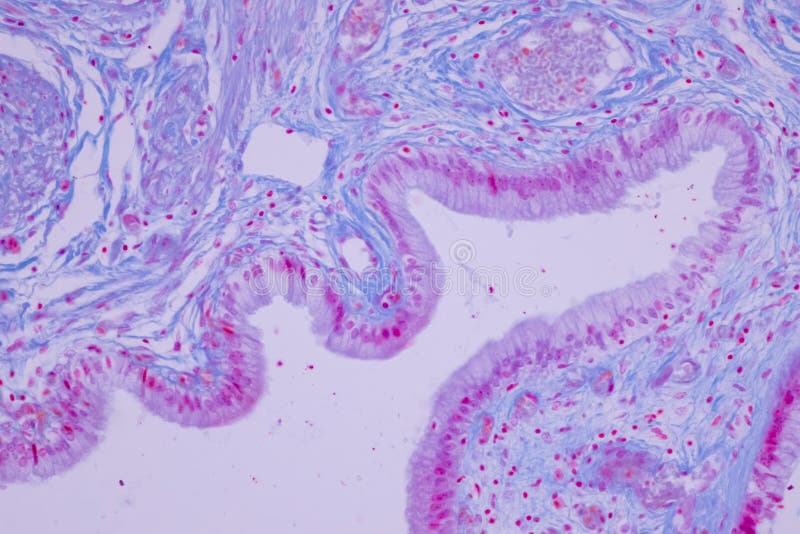 Columnar Epithelium of Human Gall Bladder Under the Microscope in Lab ...