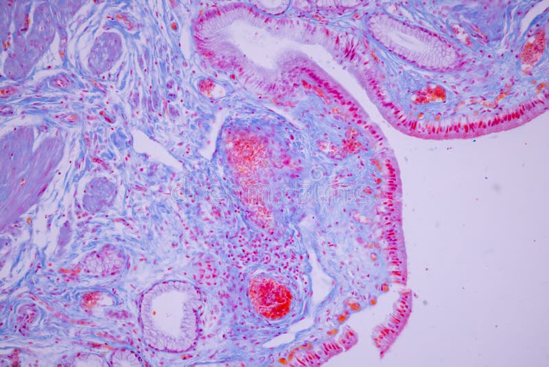 Columnar Epithelium of Human Gall Bladder Under the Microscope in Lab ...