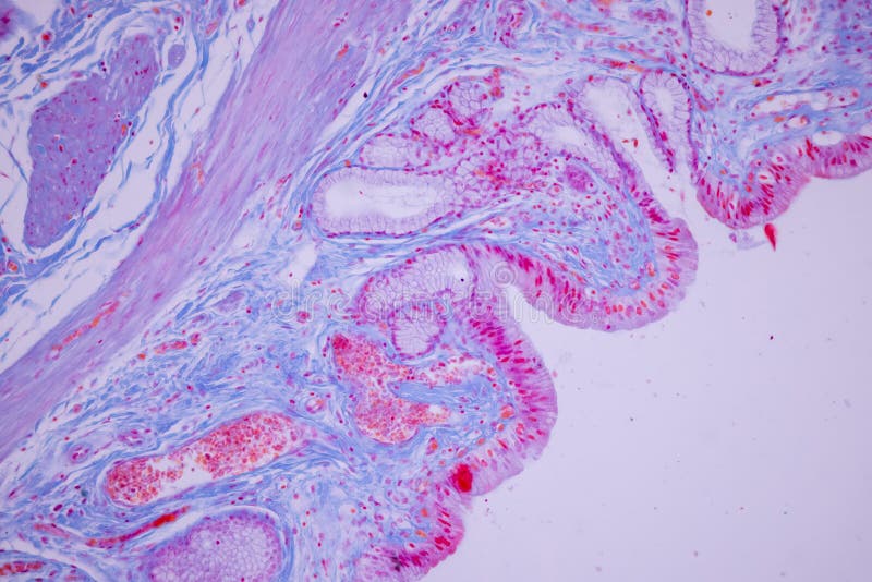 Columnar Epithelium of Human Gall Bladder Under the Microscope in Lab ...