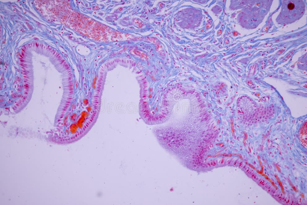 Columnar Epithelium of Human Gall Bladder Under the Microscope in Lab ...