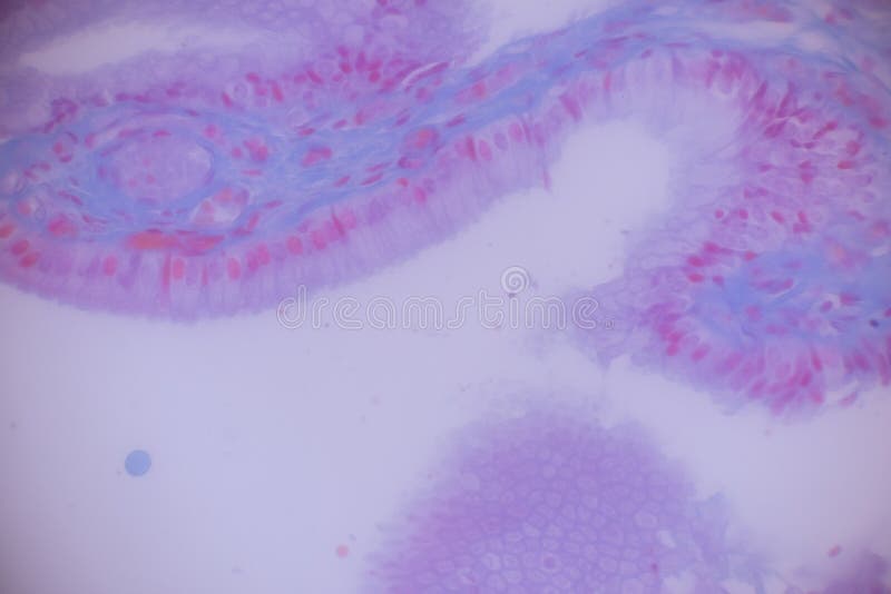 Columnar Epithelium of Human Gall Bladder Under the Microscope in Lab ...