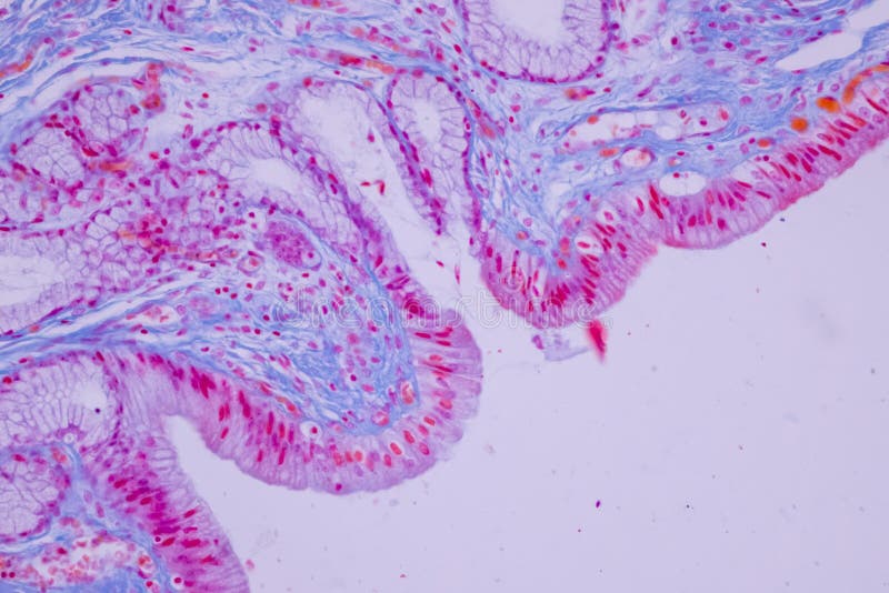 Columnar Epithelium of Human Gall Bladder Under the Microscope in Lab ...