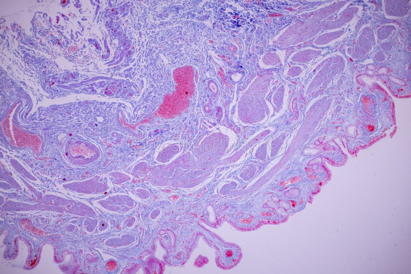 Columnar Epithelium of Human Gall Bladder Under the Microscope in Lab ...