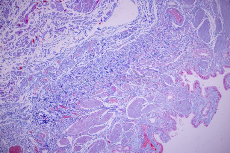 Columnar Epithelium of Human Gall Bladder Under the Microscope in Lab ...