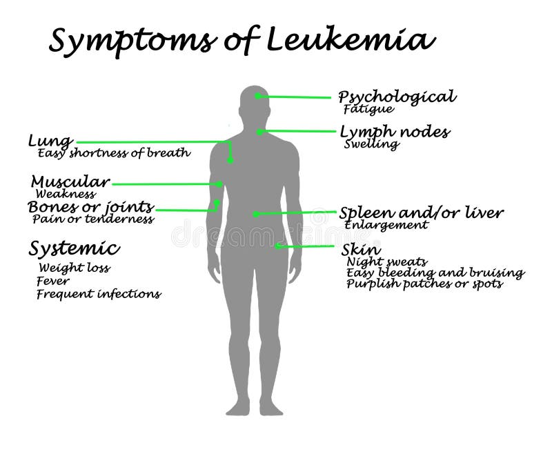 Common Symptoms And Signs Of Leukemia. Stock Vector - Illustration of ...