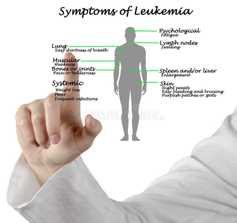 Common Symptoms of Leukemia Stock Photo - Image of loss, enlargement ...