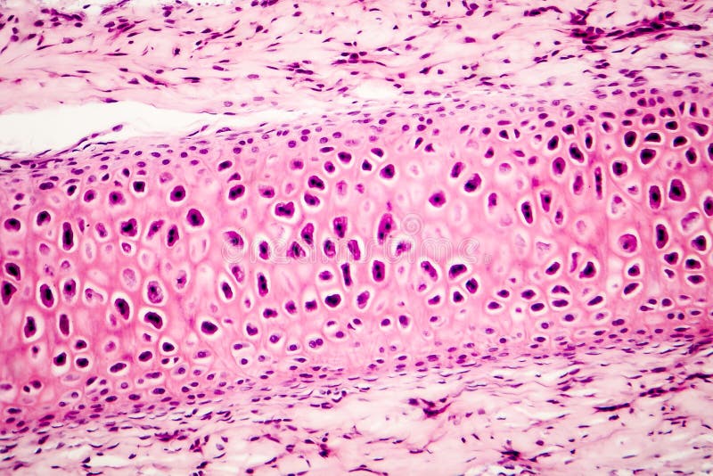 Compact bone micrograph stock image. Image of microscope - 79645269