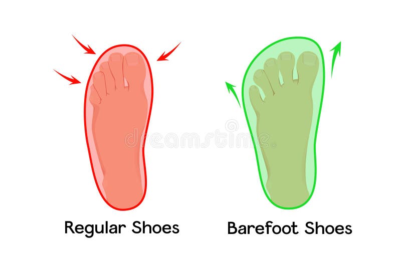 Barefoot and Regular Shoes Vector Illustration Infographic. Stock ...