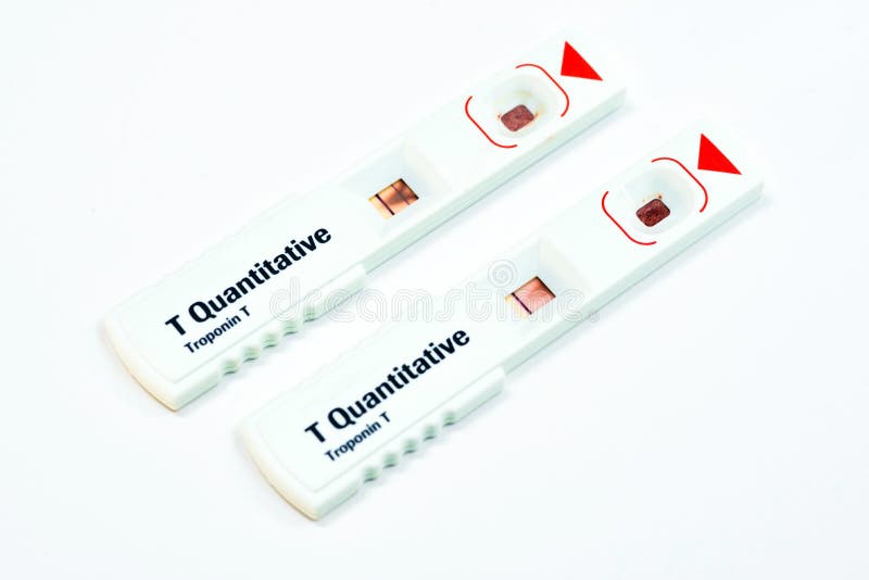 Compare Troponin T Test : Positive And Negative. Stock Image - Image of ...