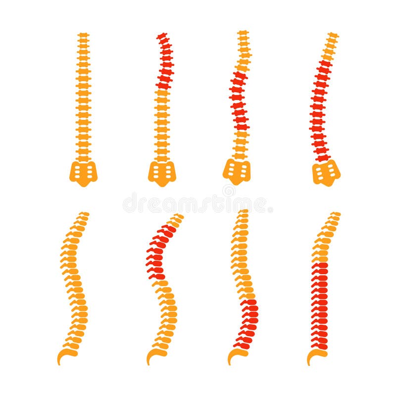 Comparing Different Human Spine Shapes with Correct and Incorrect ...