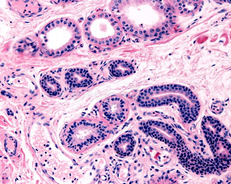 Comparison between Eccrine and Apocrine Sweat Glands Stock Image ...