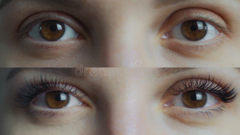 Age Comparison, Eyes of Caucasian Mother and Daughter Next To One ...