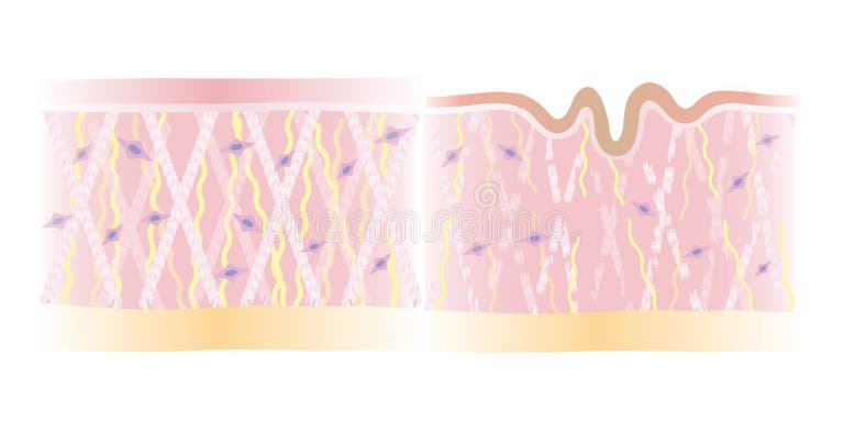 Skin Structure Vector Illustration Stock Illustrations – 8,220 Skin ... Skin Structure Vector Illustration Stock Illustrations – 8,220 Skin ...