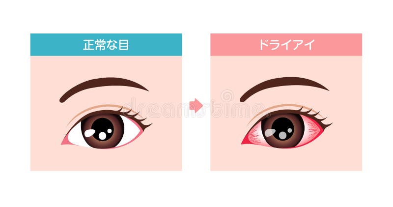 Japanese Eye Shape