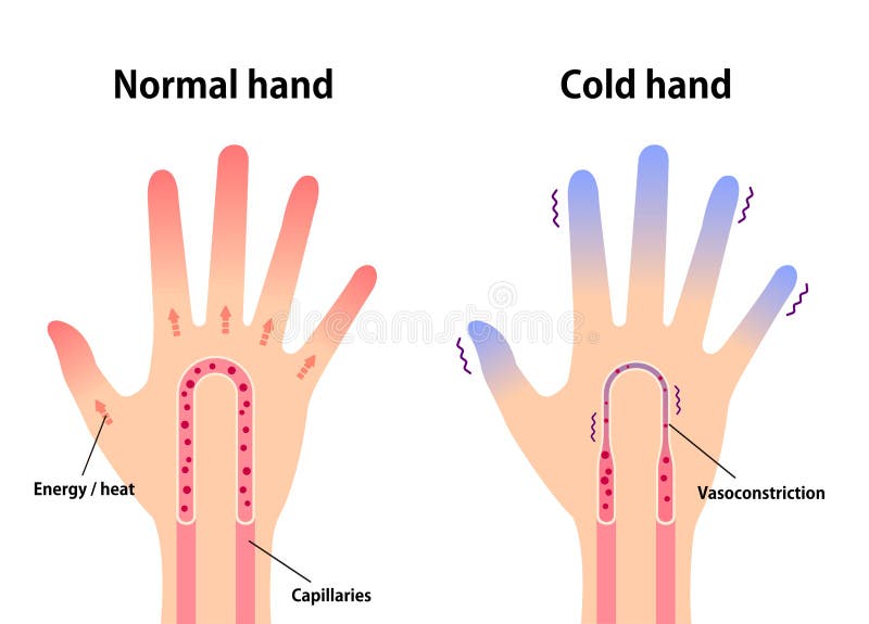 Temperature Comparison Stock Illustrations – 317 Temperature Comparison ...