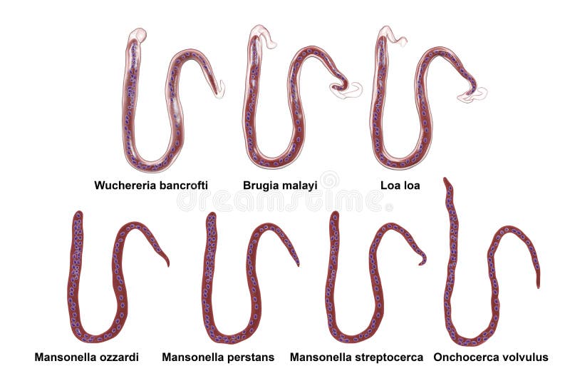 Mansonella Streptocerca, a Roundworm Nematoda that Causes ...