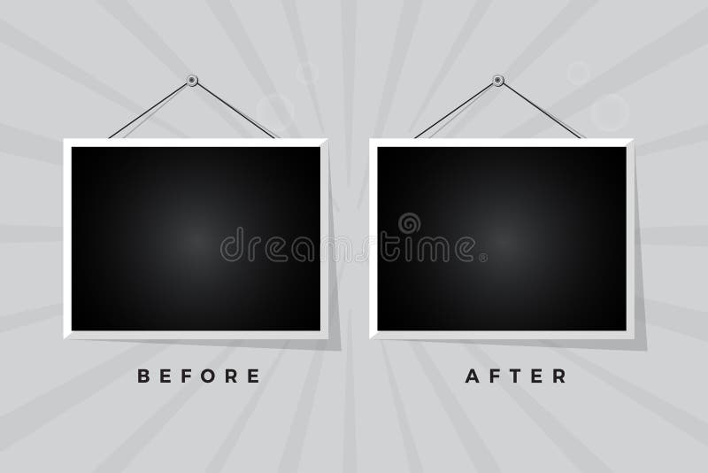 Comparison before and after Photo Frame Blue Gradient Background Stock ...