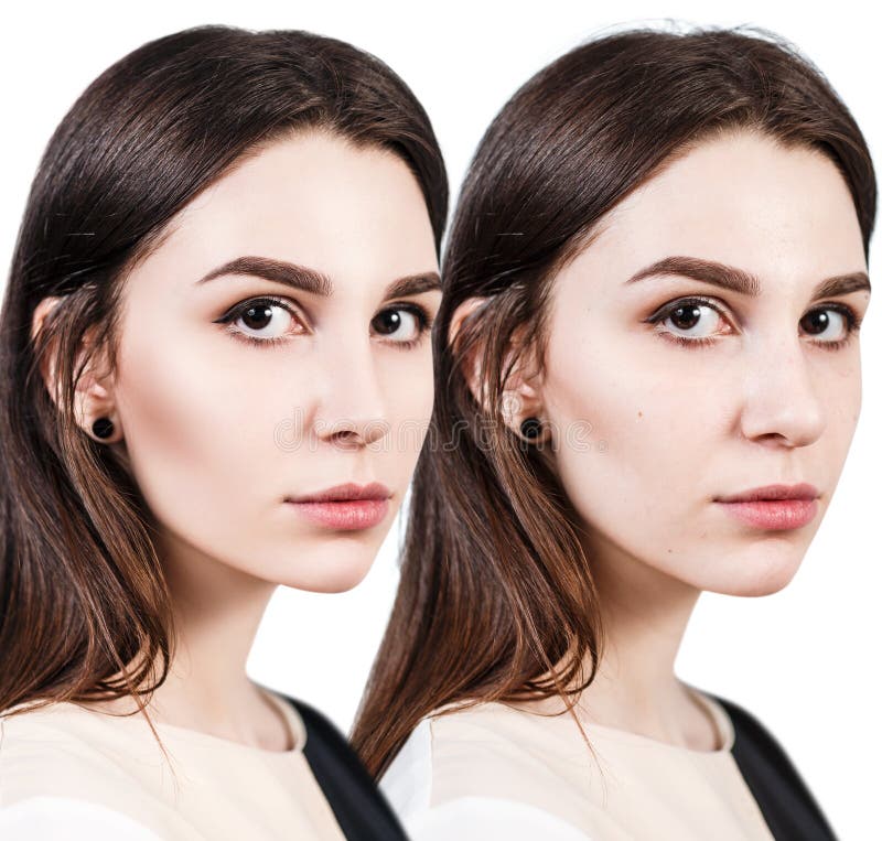 Comparison Portrait of Young Woman Stock Image - Image of acne, closeup ...