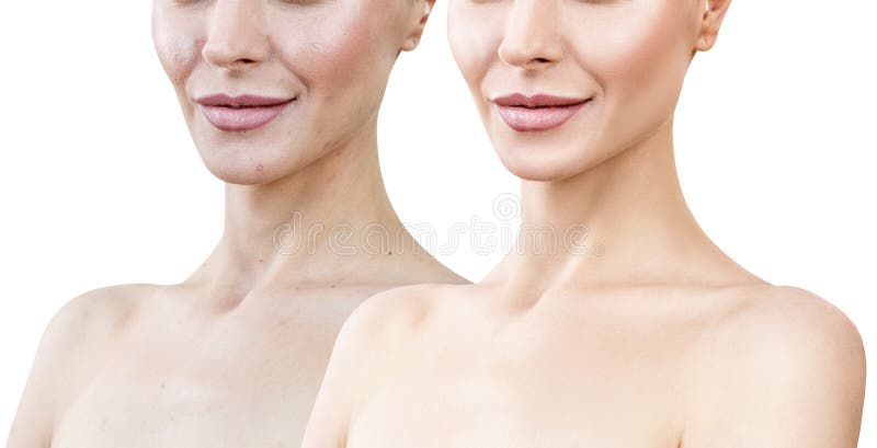 Comparison Portrait of Young Woman Stock Photo - Image of model ...