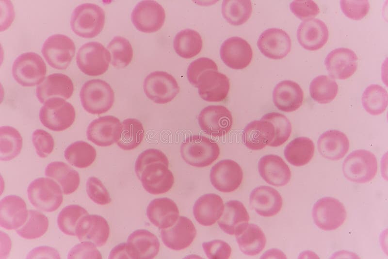 Complete blood count stock photo. Image of eosinophil - 60052608