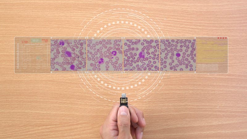 Complete Blood Count Testing Your Self at Home. Stock Video - Video of ...